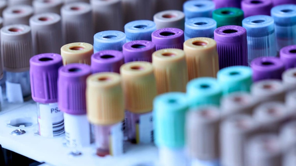 Sanofi: Dupixent y las vacunas mejoran la proyección del valor